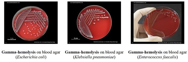 Blood Agar- Composition, Preparation, Uses and Pictures
