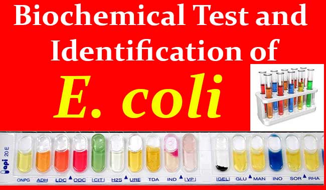 Biochemical Test and Identification of E. coli