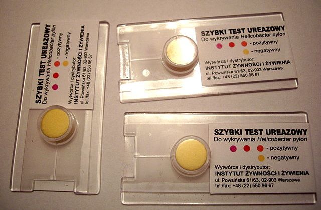 Urease Test- Principle, Media, Procedure and Result