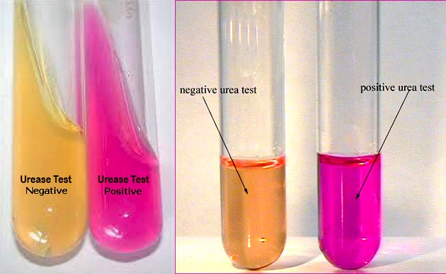 Urease Test- Principle, Media, Procedure and Result