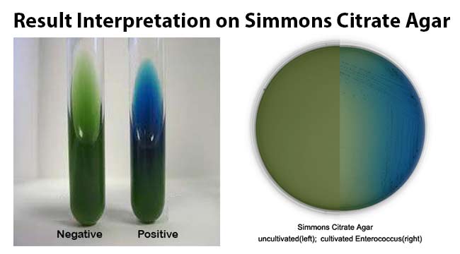 Simmons Citrate Agar- Composition, Principle, Uses, Preparation and ...