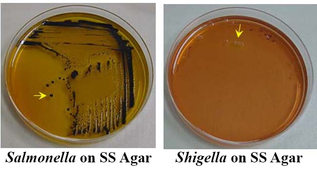 Salmonella Shigella (SS) Agar- Composition, Principle, Uses ...
