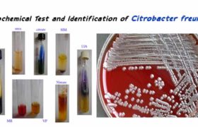Online Microbiology Notes